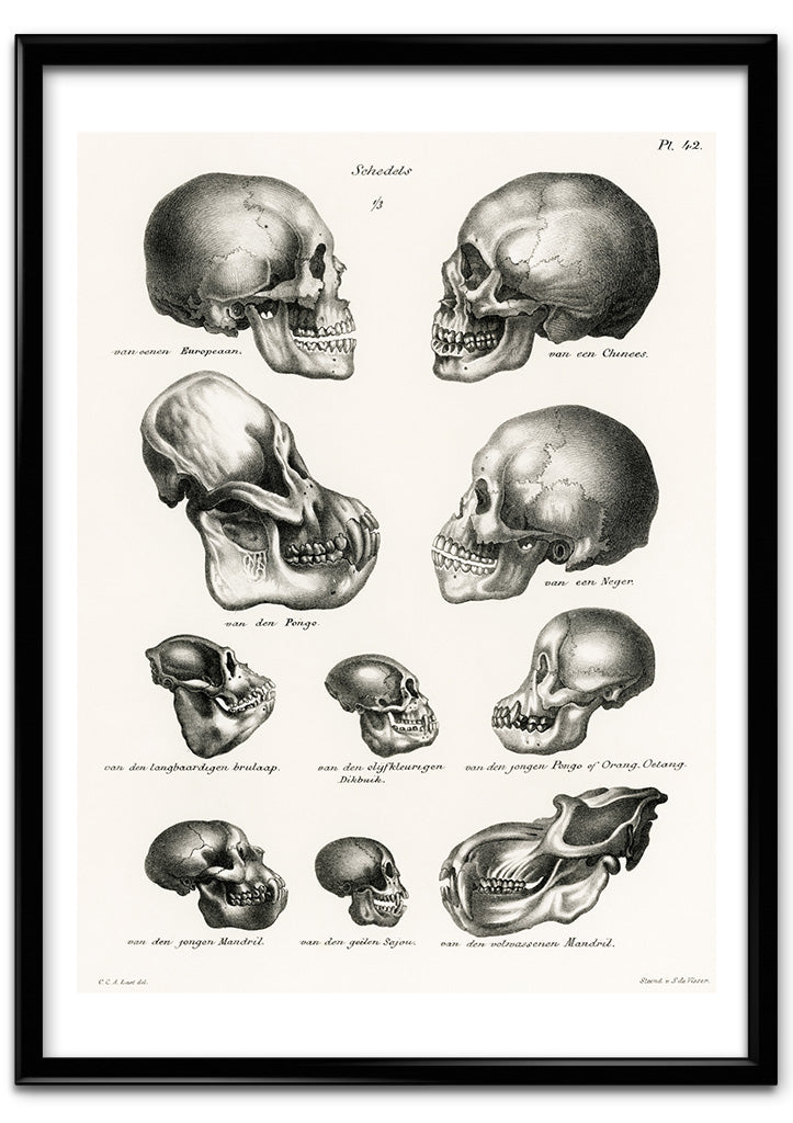 Anatomy Poster - Vintage Skull Anatomical Illustration – Posterist